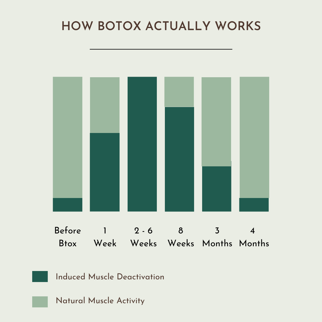 How Long Does Botox Last The Facts Alabaster Aesthetics