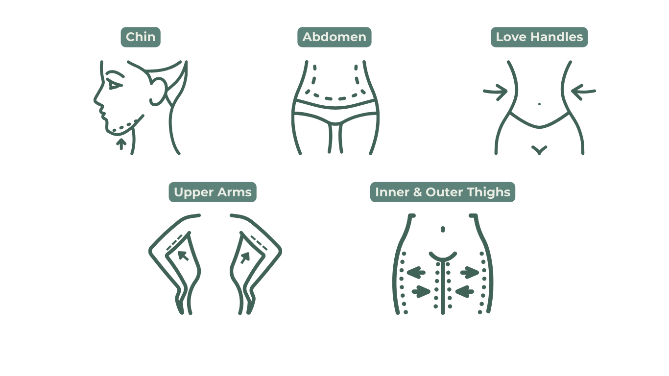 Lemon Bottle Fat Dissolving - Alabaster Aesthetics